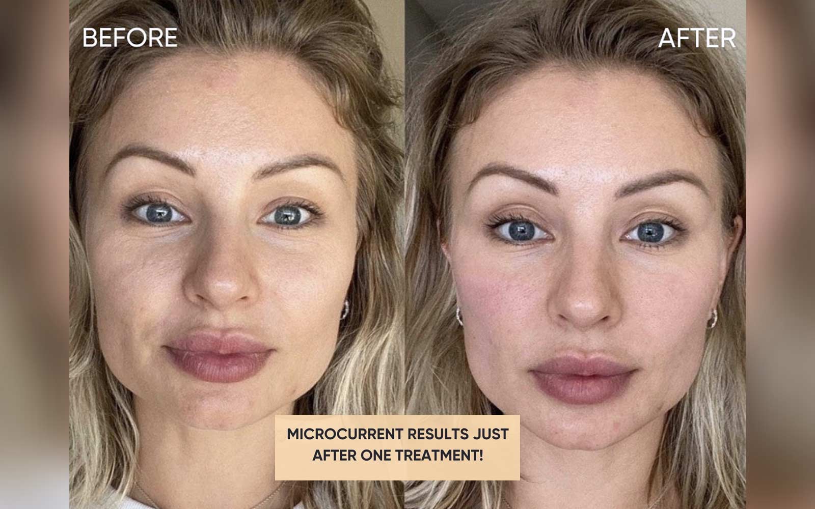 Microcurrent - ViaCosmetic